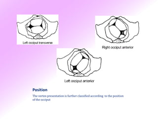 Practical partography | PDF
