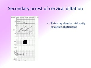 Practical partography | PDF