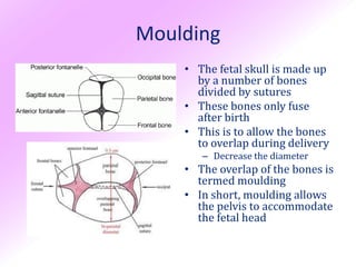 Practical partography | PDF