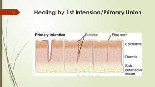 Practical Phagocytosis and REPAIR AREGENERATION PROCESSES.pptx