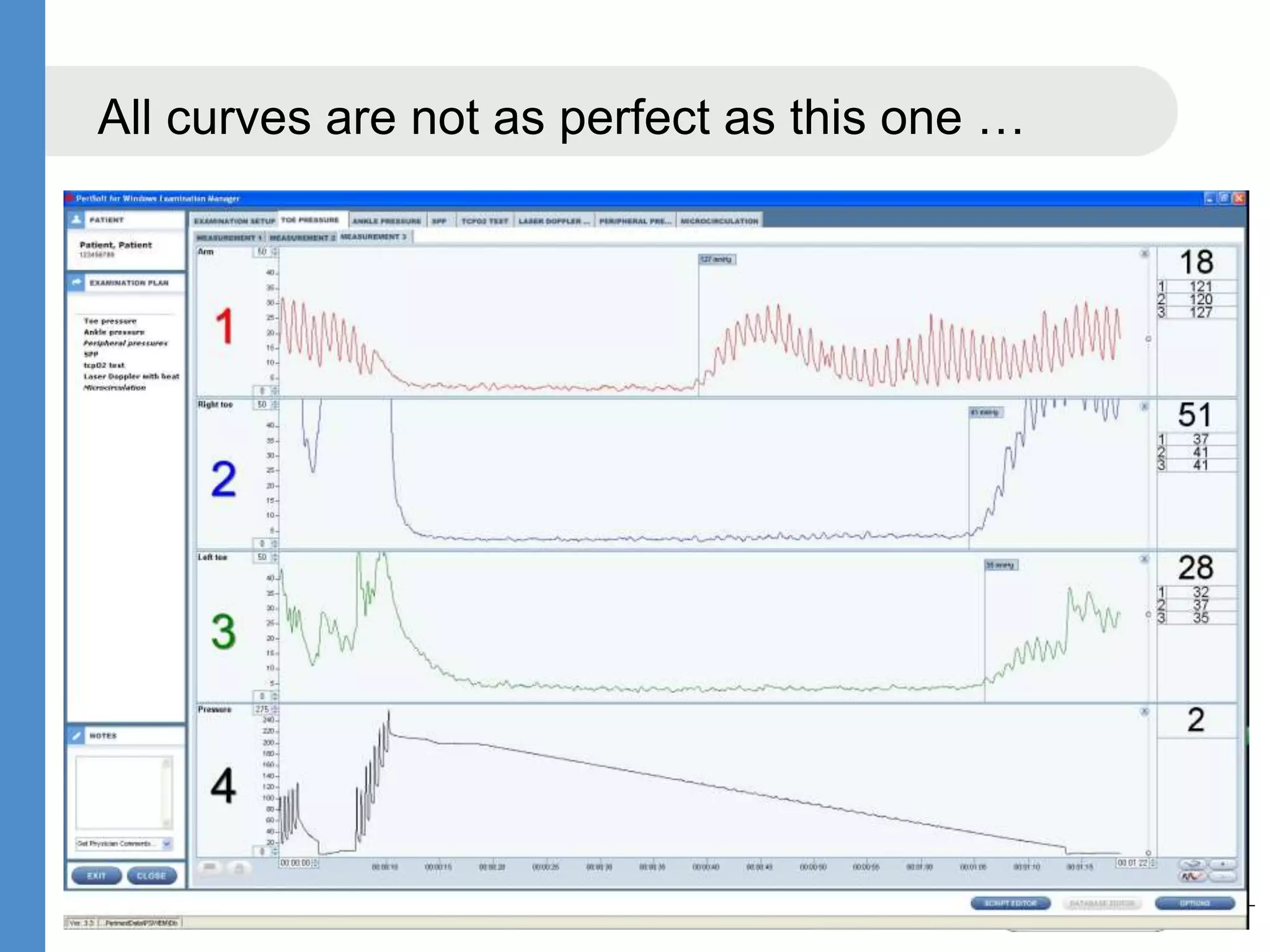 Interpreting toe and ankle pressure curves and results when using ...