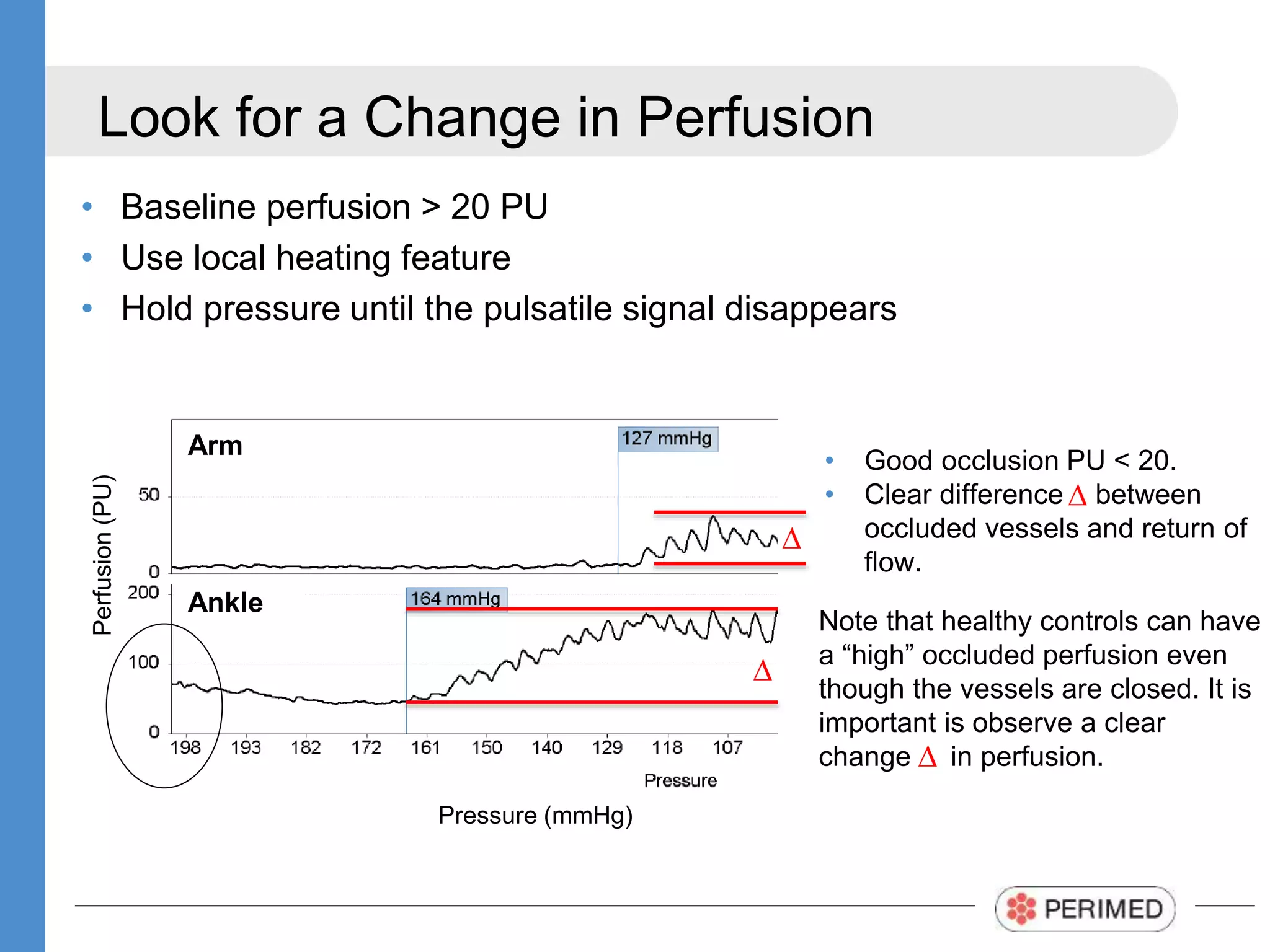 Interpreting toe and ankle pressure curves and results when using ...