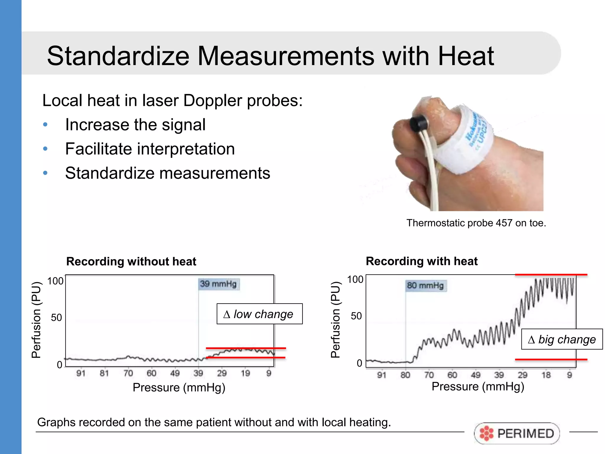 Interpreting toe and ankle pressure curves and results when using ...