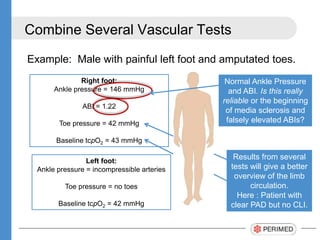 Interpreting toe and ankle pressure curves and results when using ...