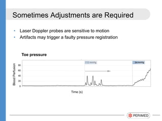 Interpreting toe and ankle pressure curves and results when using ...