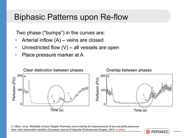 Interpreting toe and ankle pressure curves and results when using ...