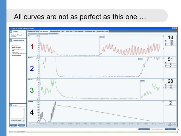 Interpreting toe and ankle pressure curves and results when using ...