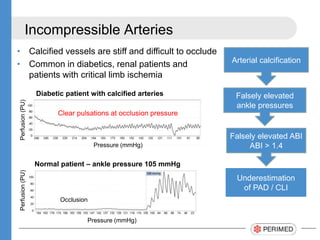 Interpreting toe and ankle pressure curves and results when using ...
