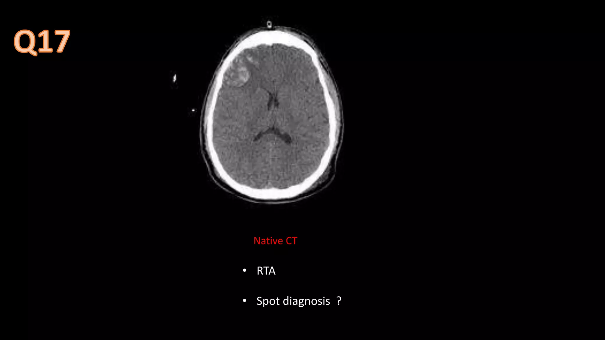 neuroradiology quiz module | PPTX