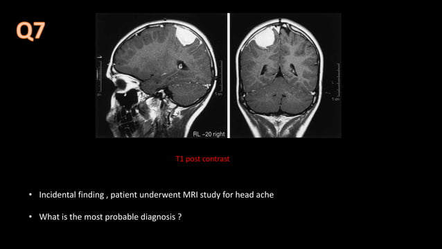 neuroradiology quiz module | PPTX | Brain and Nervous System Disorders ...