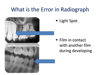 Practical Radiographs Pptx