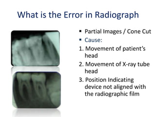 Practical radiographs | PPTX