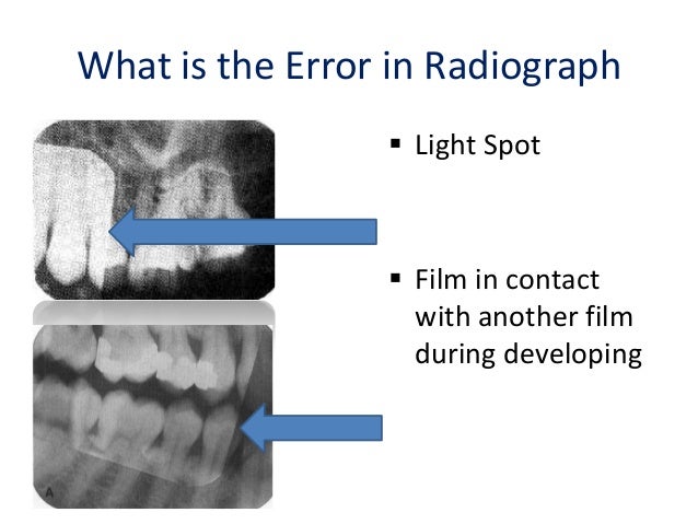 Practical Radiographs