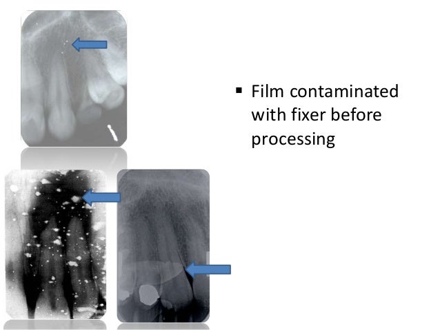 Practical radiographs