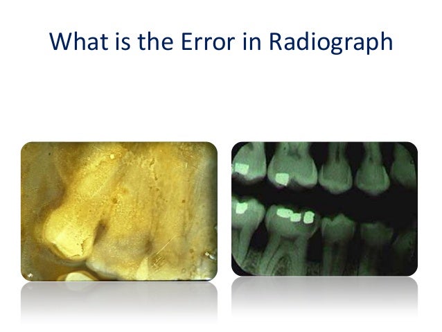 Practical radiographs