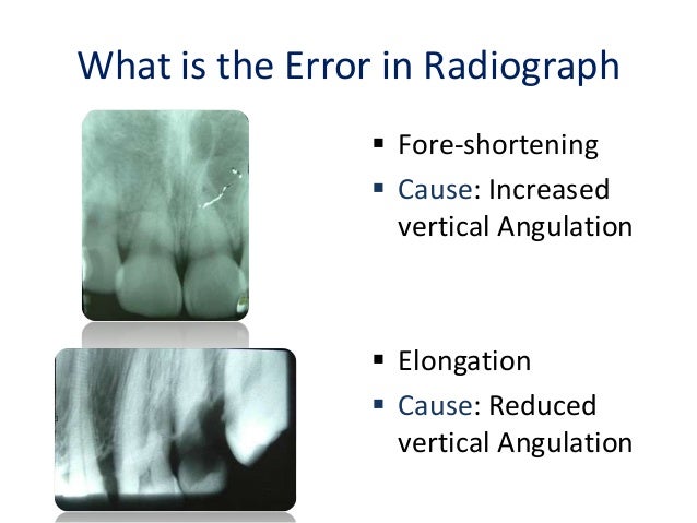 Practical radiographs