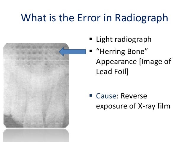 Practical radiographs