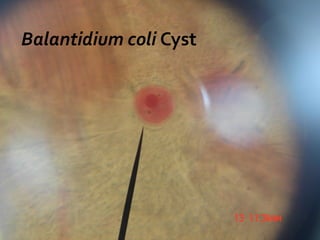 Practical revision part 2 protozoa | PDF