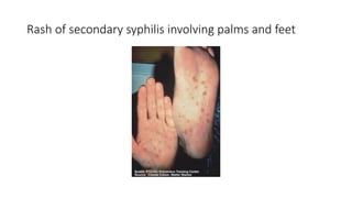 Practicals 1 5 infectiuos diseases | PPTX