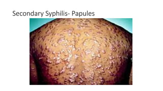 Practicals 1 5 infectiuos diseases | PPTX