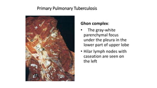 Practicals 1 5 infectiuos diseases | PPTX