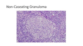 Practicals 1 5 infectiuos diseases | PPTX