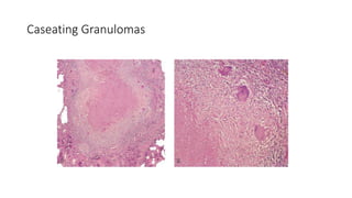 Practicals 1 5 infectiuos diseases | PPTX