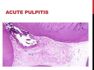Practical section of pulp and periapical diseases | PPTX