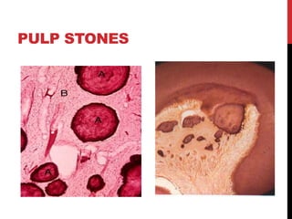 Practical section of pulp and periapical diseases | PPTX