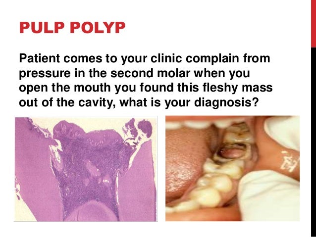 Practical section of pulp and periapical diseases