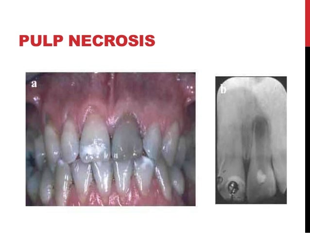 Practical section of pulp and periapical diseases