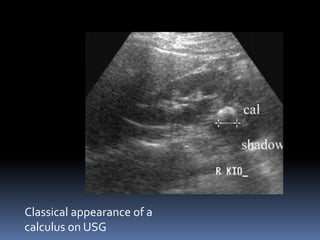 Practical tips in sonography | PPTX | Digestive Disorders | Diseases ...