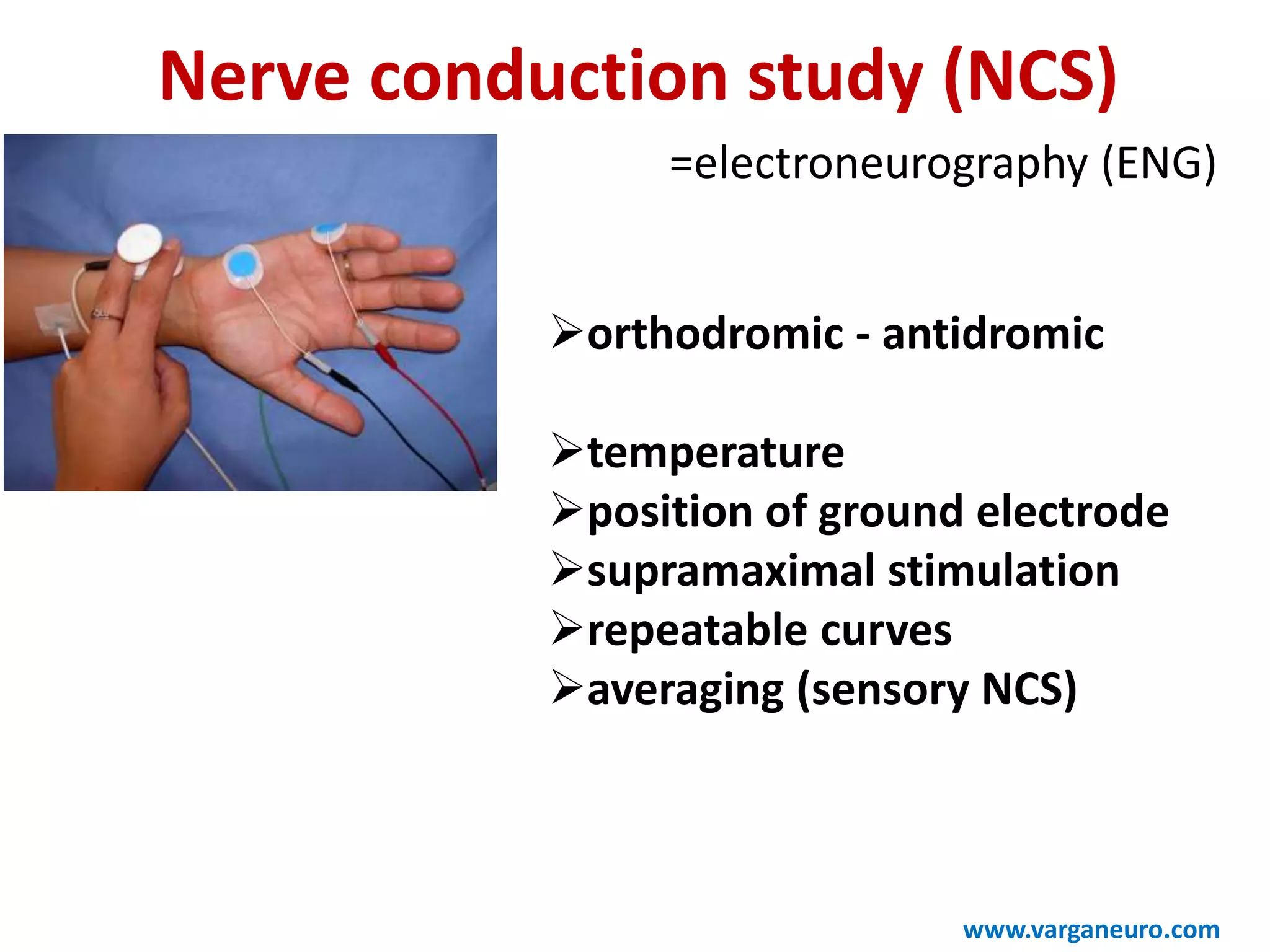 Practical tips for trainees: Nerve conduction studies, near nerve ...