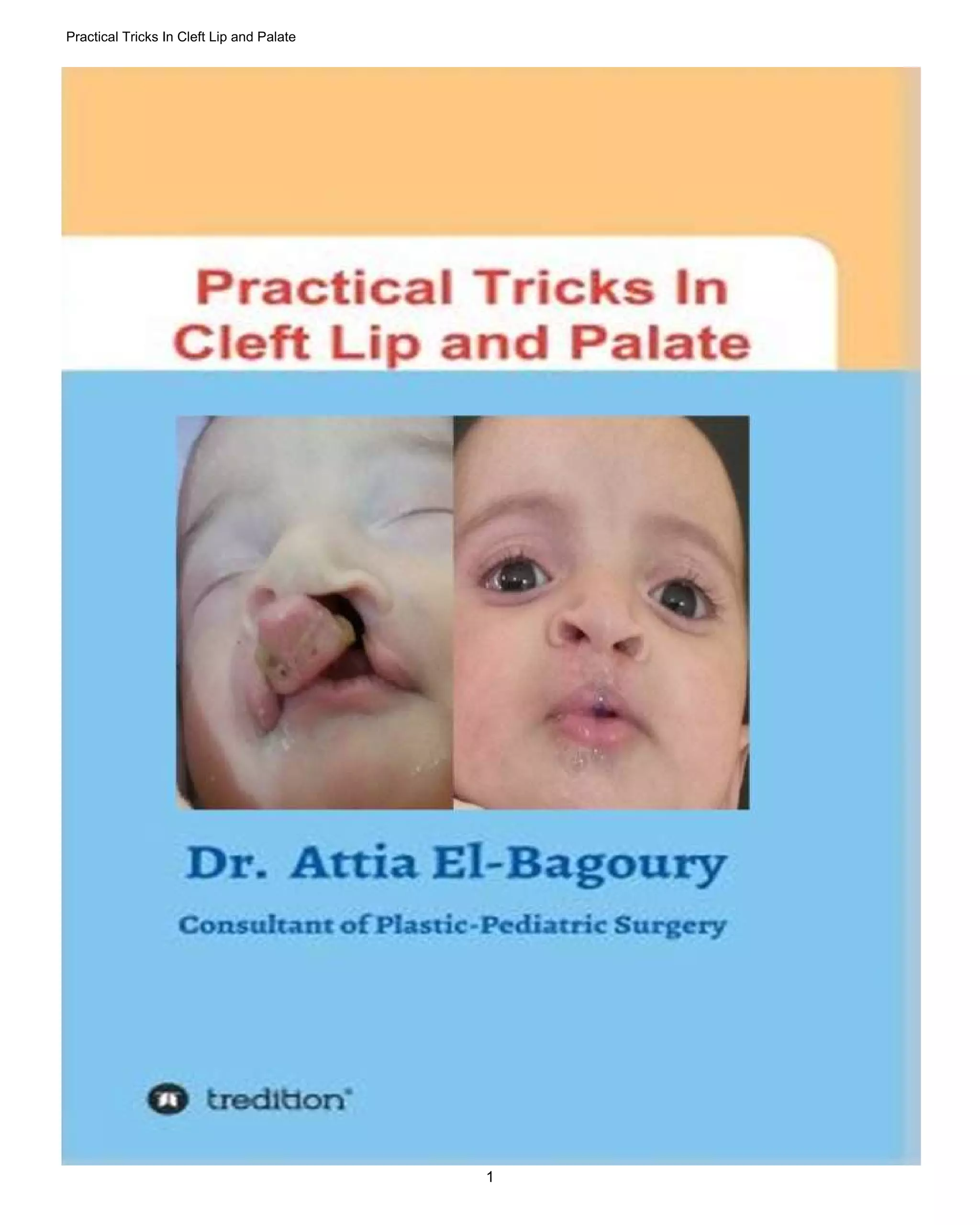 Practical tricks in cleft lip and palate | PDF