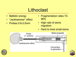 Practical_Ureteroscopy.ppt tai lieu ve ureteroscopy | PPT