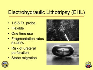 Practical_Ureteroscopy.ppt tai lieu ve ureteroscopy | PPT