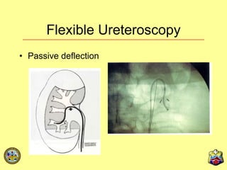 Practical_Ureteroscopy Đinh Thị Hảo .ppt
