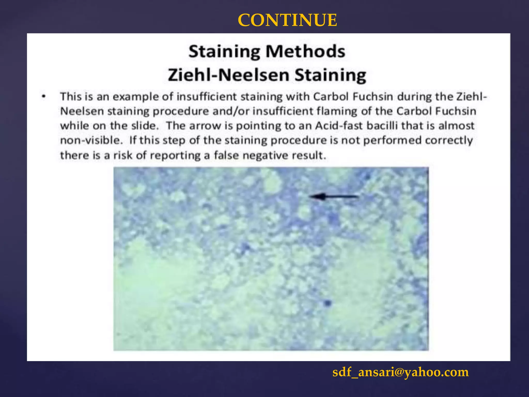 Practical z n staining | PPTX