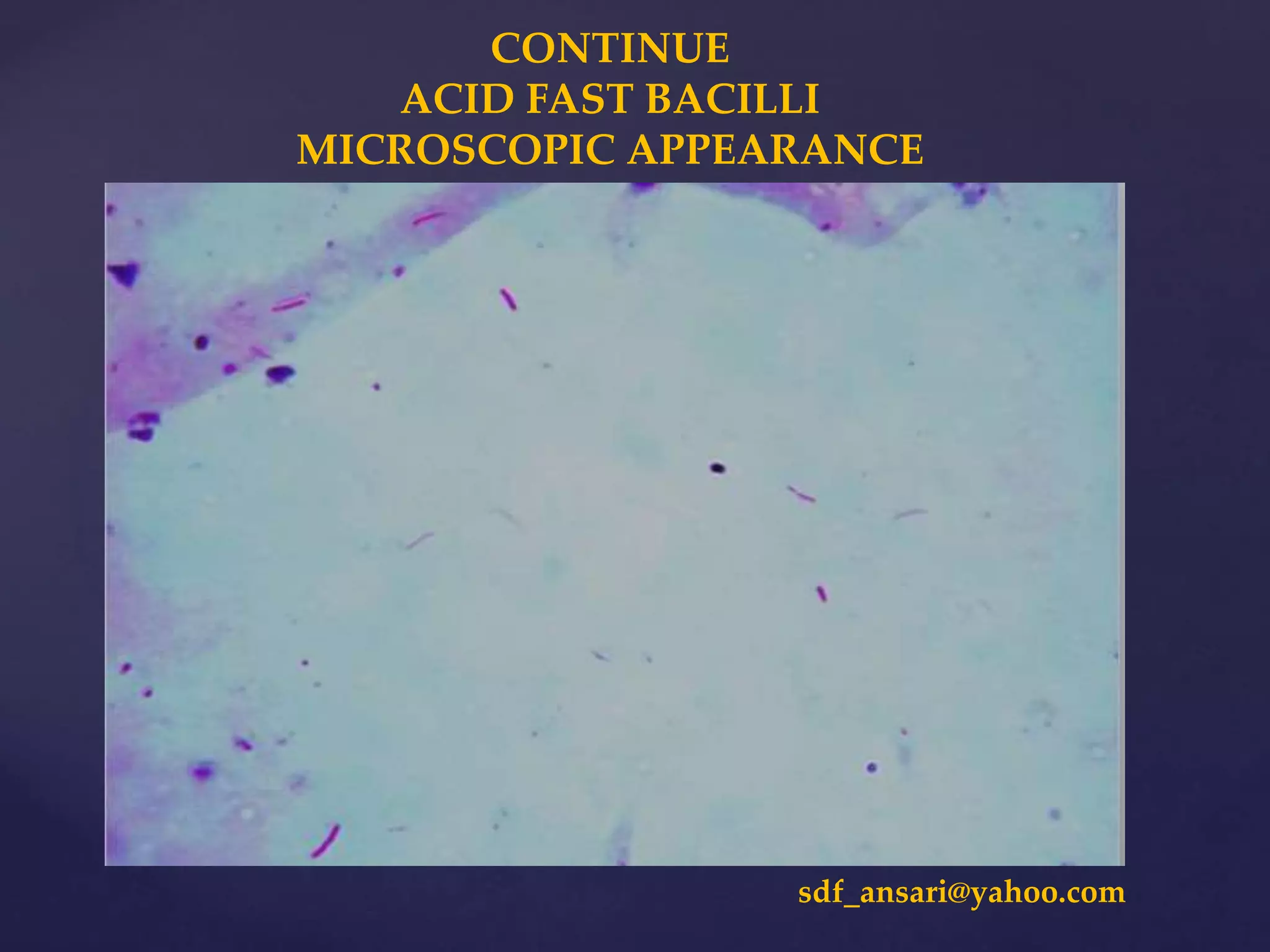 Practical z n staining | PPTX