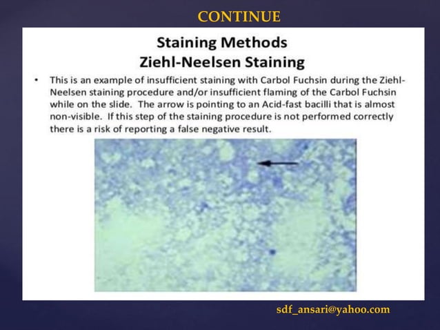Practical z n staining | PPTX