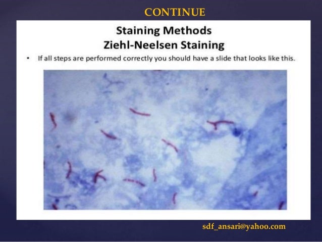 Practical z n staining