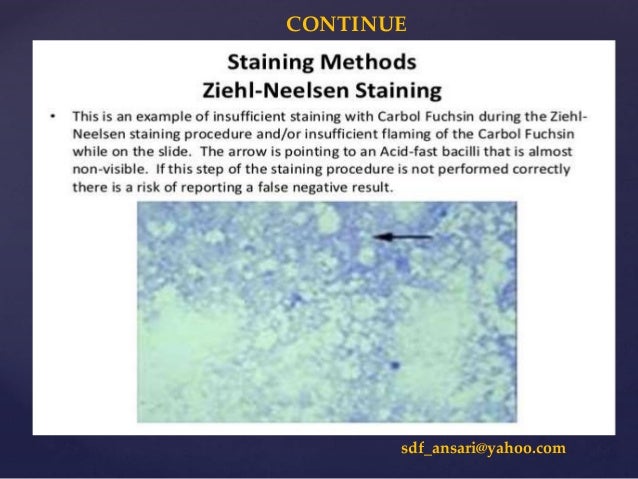 Practical z n staining