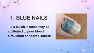 Practice Basic Nail Design - Copy.pptx.. | PPTX