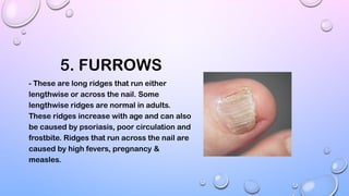 Practice Basic Nail Design - Copy.pptx.. | PPTX