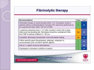 Practice of preparation and administration of tenecteplase | PPT