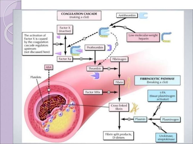 Practice of preparation and administration of tenecteplase | PPT