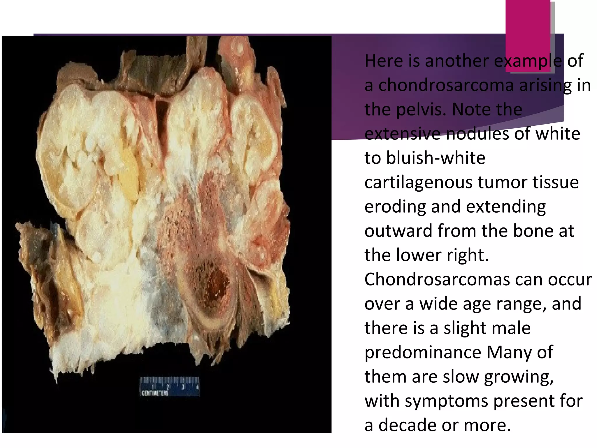 Practicals MUSCULOSKELETAL SYSTEM | PPT