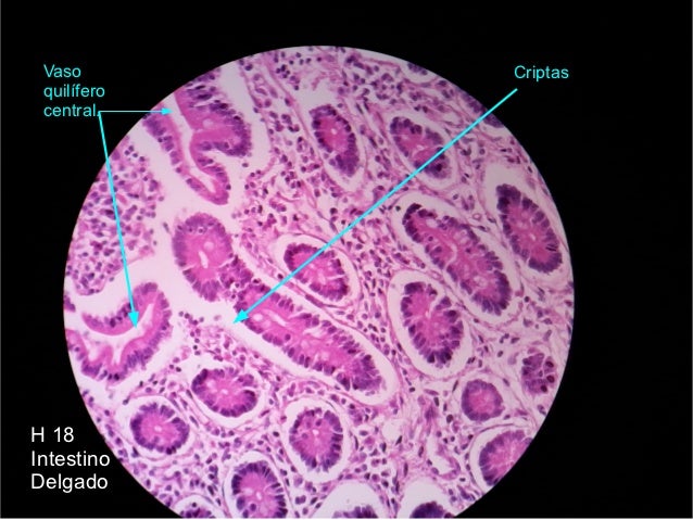 Practico 17 digestivo ii
