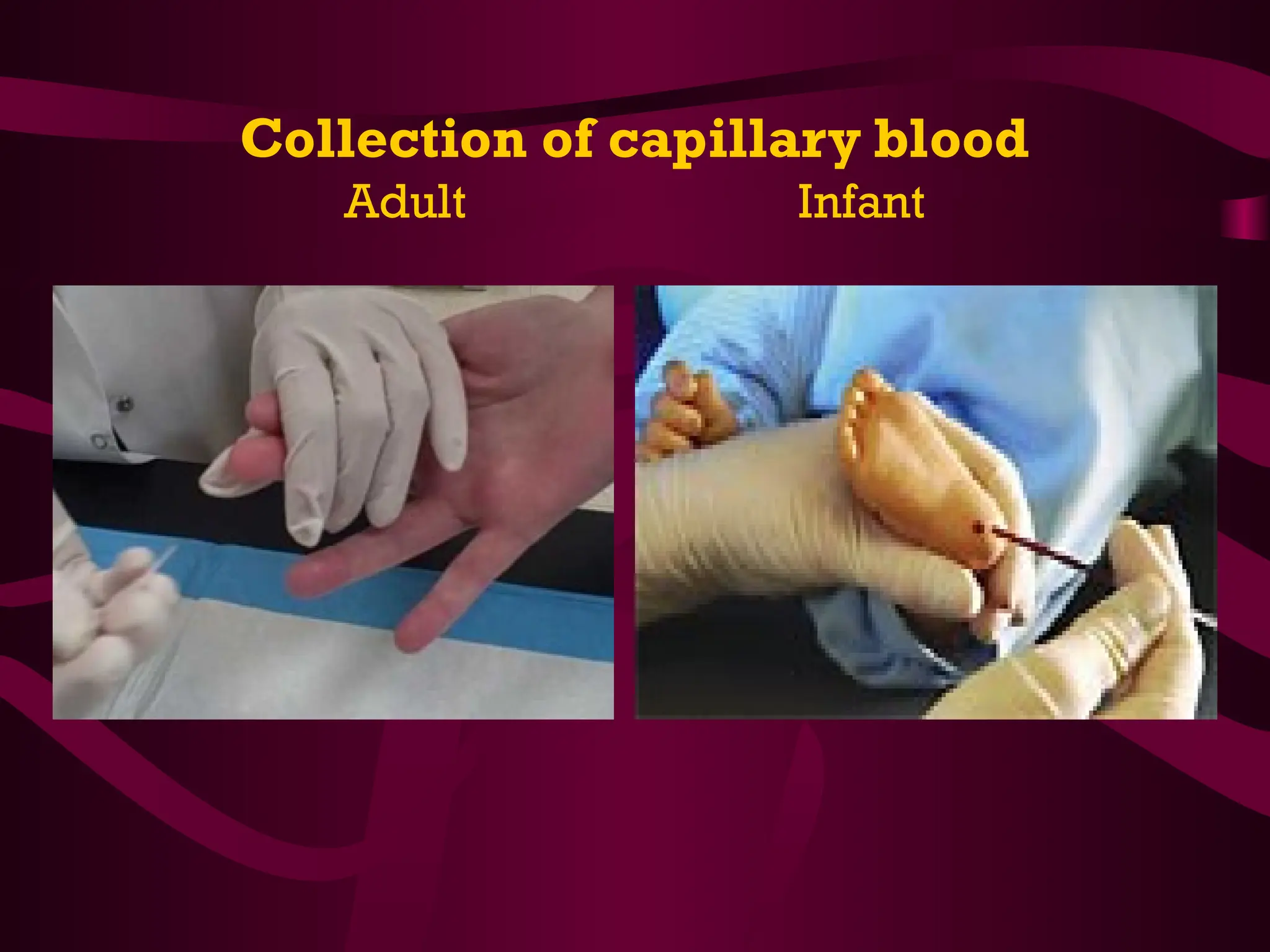 Pract no-2 Blood collection and hemoglobin.ppt