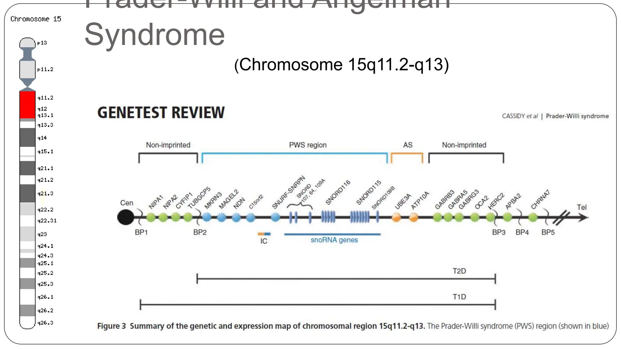 Prader Willi syndrome and Genetics and differentials | PPTX